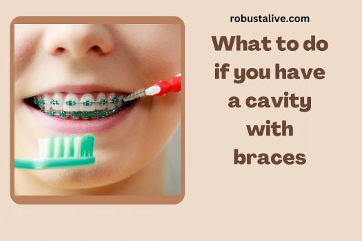 What to Do If You Have a Cavity with Braces? - Robustalive