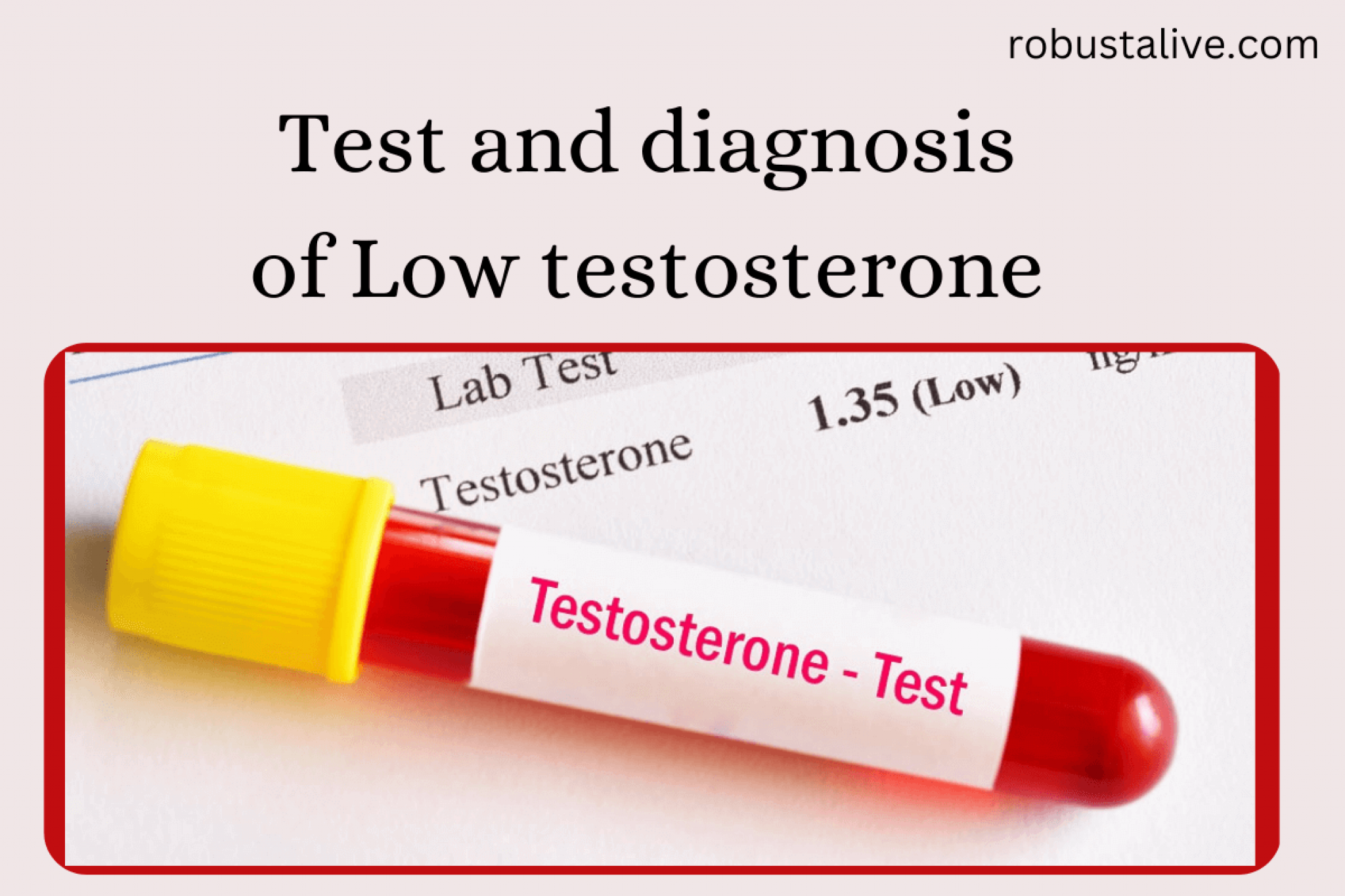 What is a normal level of testosterone in males by age? - Robustalive