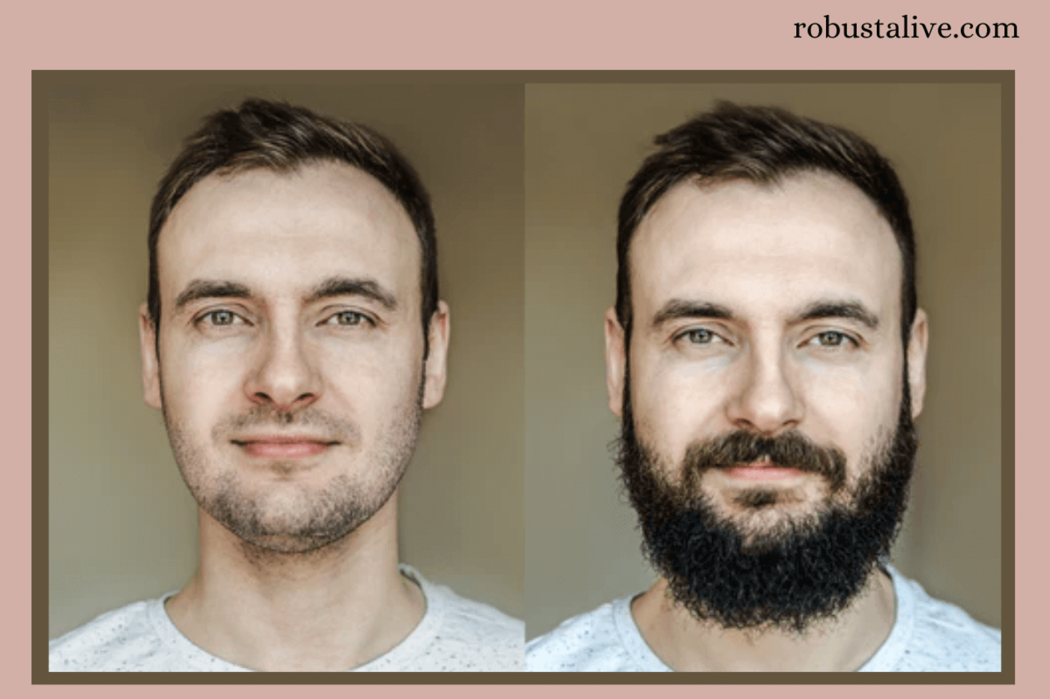 Will testosterone help grow a beard? - Robustalive