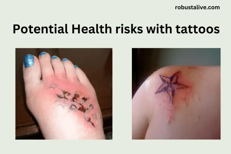 Is a tattoo bad for health? Health risks - Robustalive