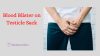 Blood Blister on Testicle Sack - Causes, Symptoms, and Treatment